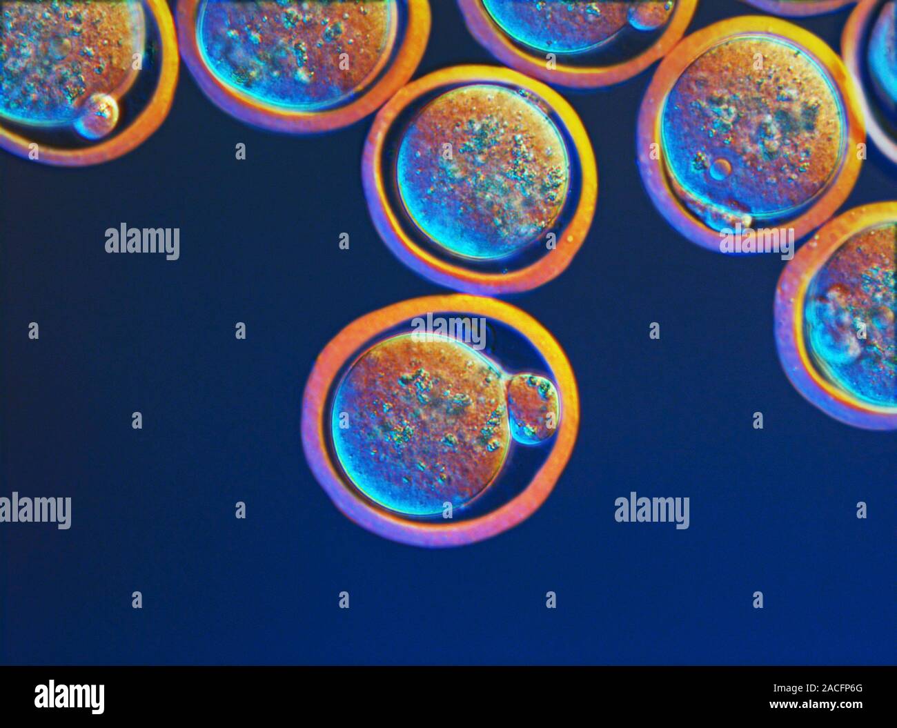 Pronuclear egg cells. Polarised light micrograph of eggs (female ...
