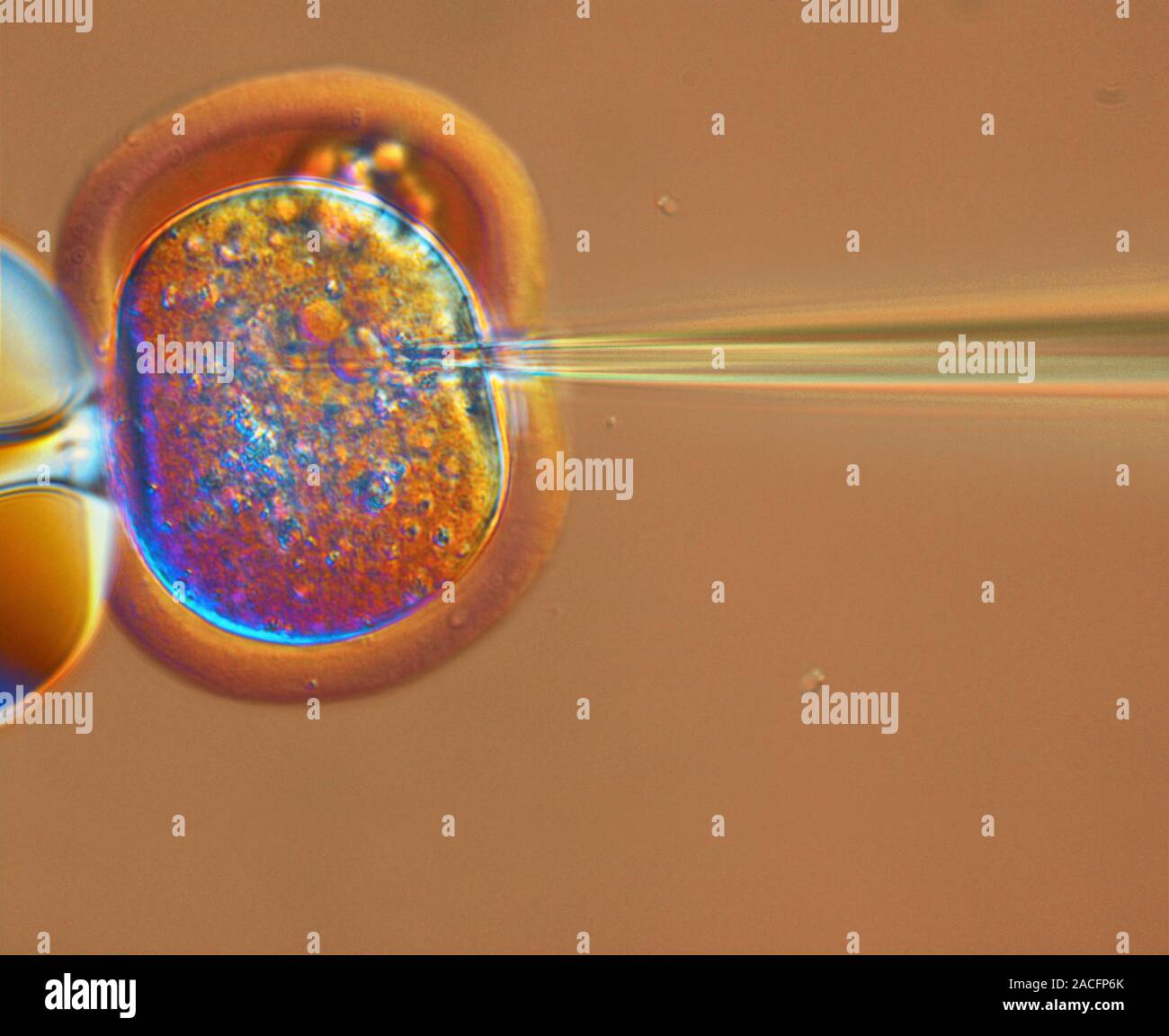 Injecting genetic material, polarised light micrograph. Foreign DNA ...