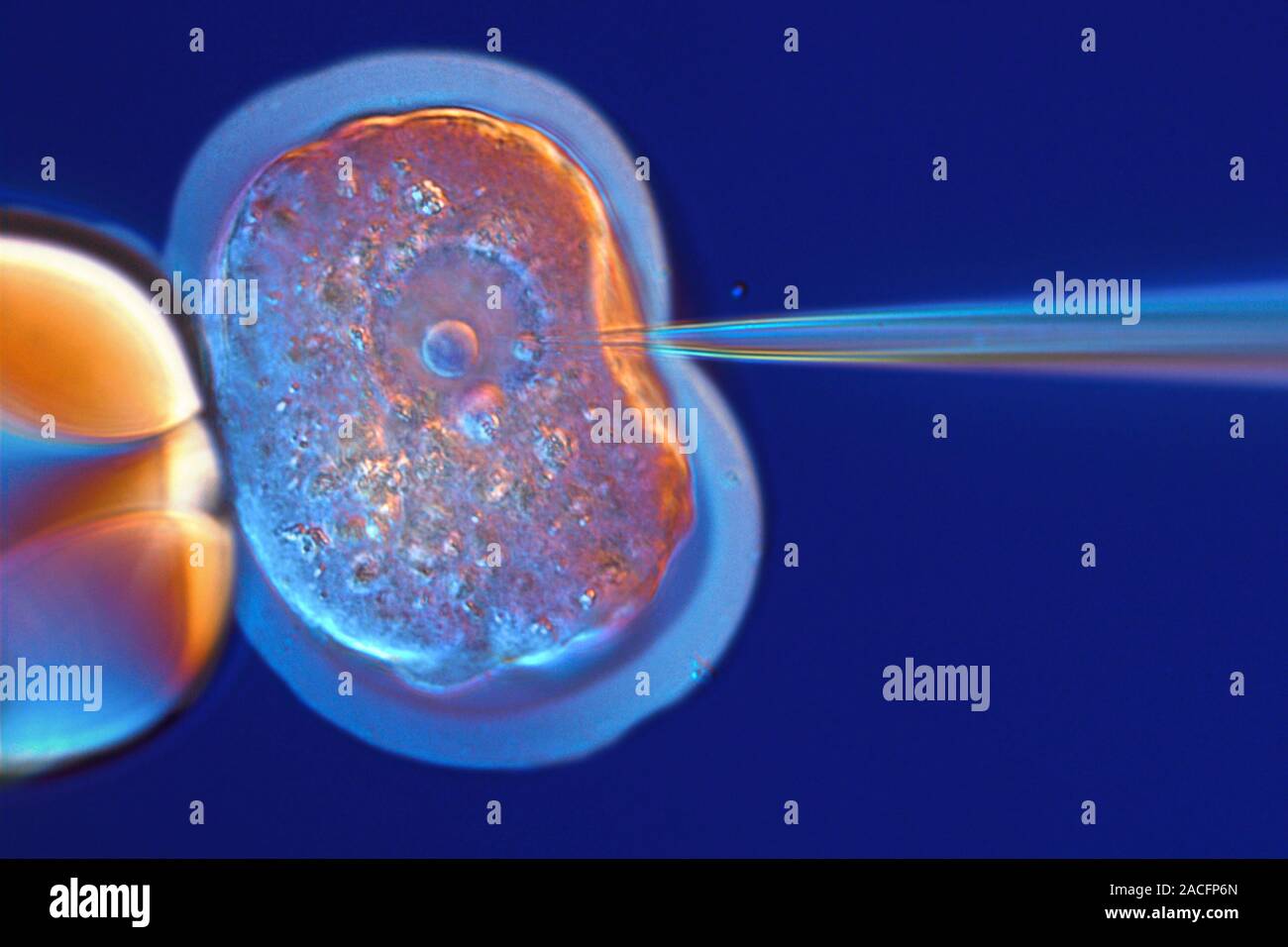 Injecting genetic material, polarised light micrograph. Foreign DNA ...
