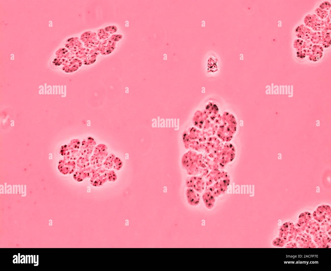 Salt lake bacteria, light micrograph. These bacteria are from Lake ...