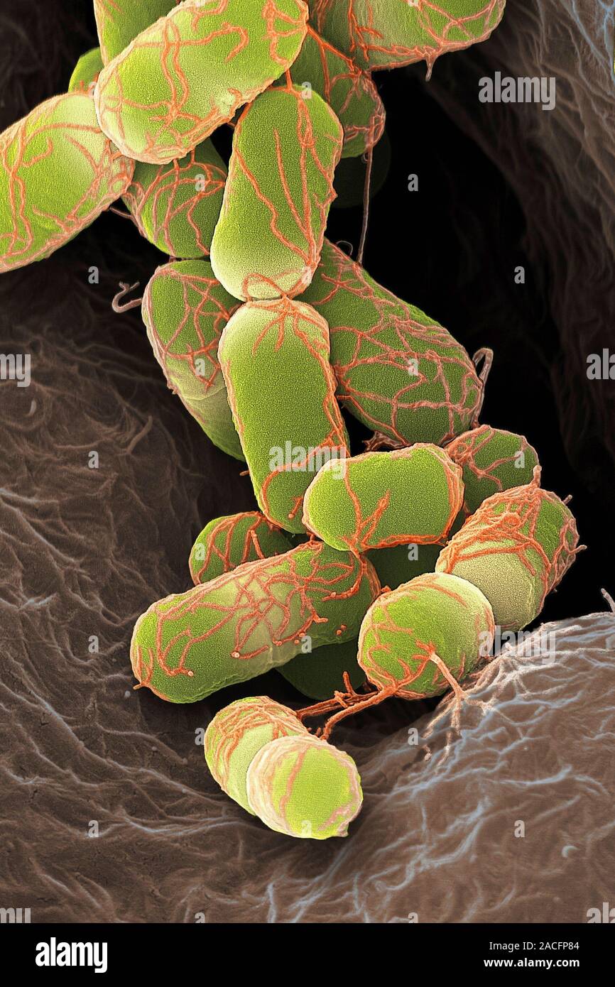 Escherichia coli bacteria, coloured scanning electron micrograph (SEM ...