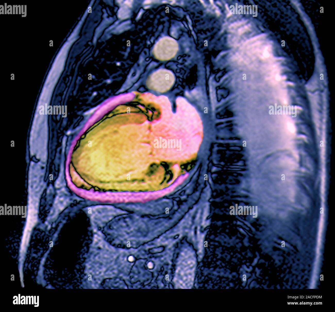 Coloured MRI scan of a sagittal (longitudinal) section through the ...