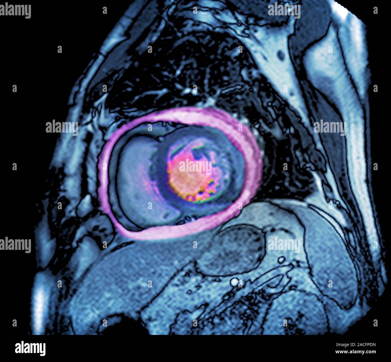 Coloured MRI scan of a sagittal (longitudinal) section through the ...