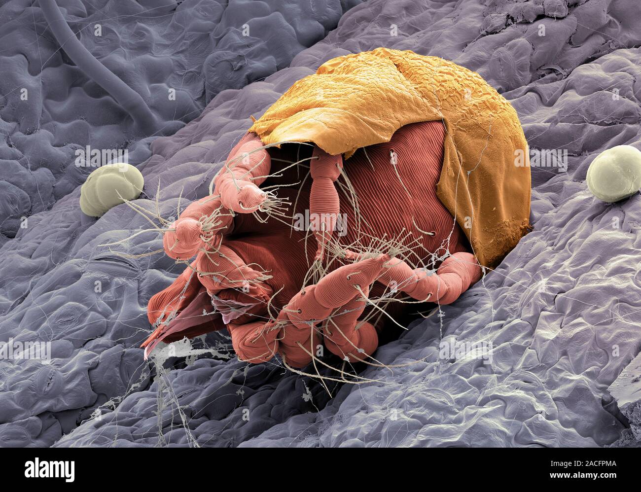 Spider mite. Coloured scanning electron micrograph (SEM) of a spider ...