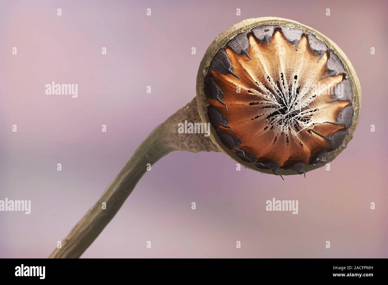 Moss spore capsule. Coloured scanning electron micrograph (SEM) of the ...