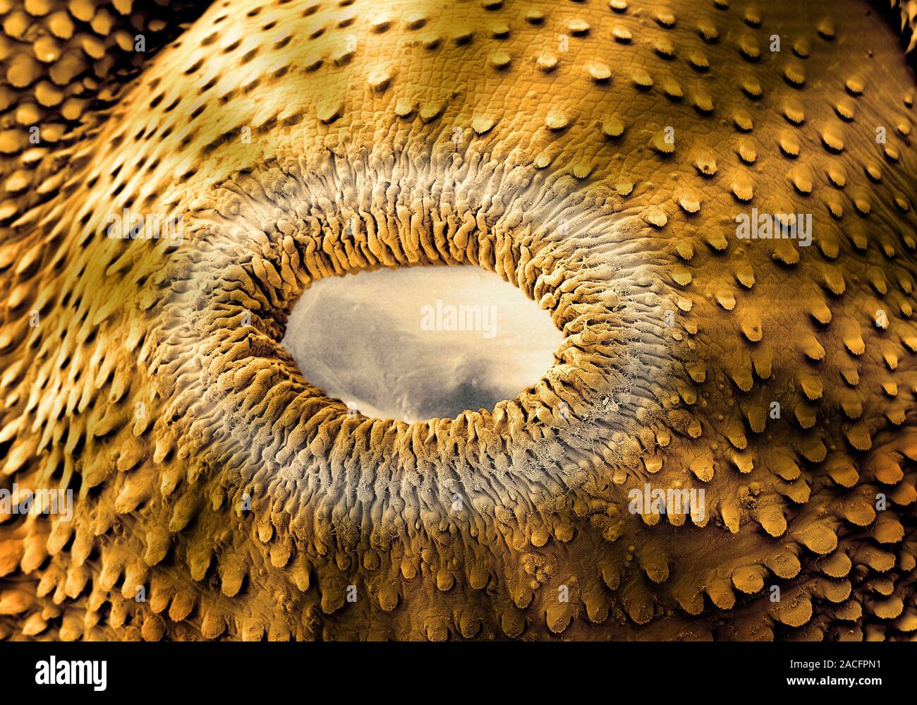 Leech sucker. Coloured scanning electron micrograph (SEM) of the body ...