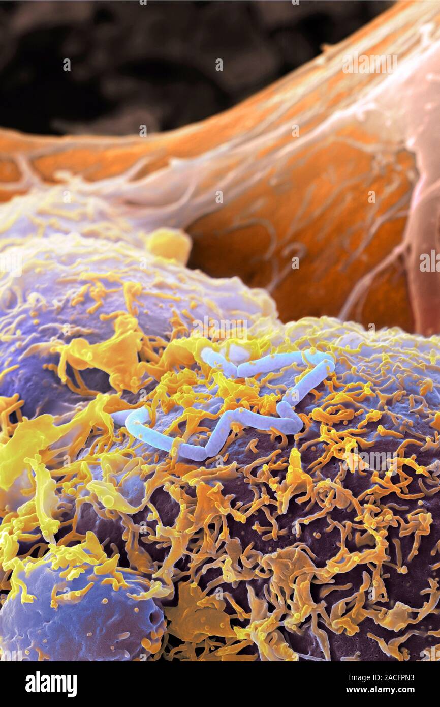Listeria sp. bacteria, coloured scanning electron micrograph (SEM ...