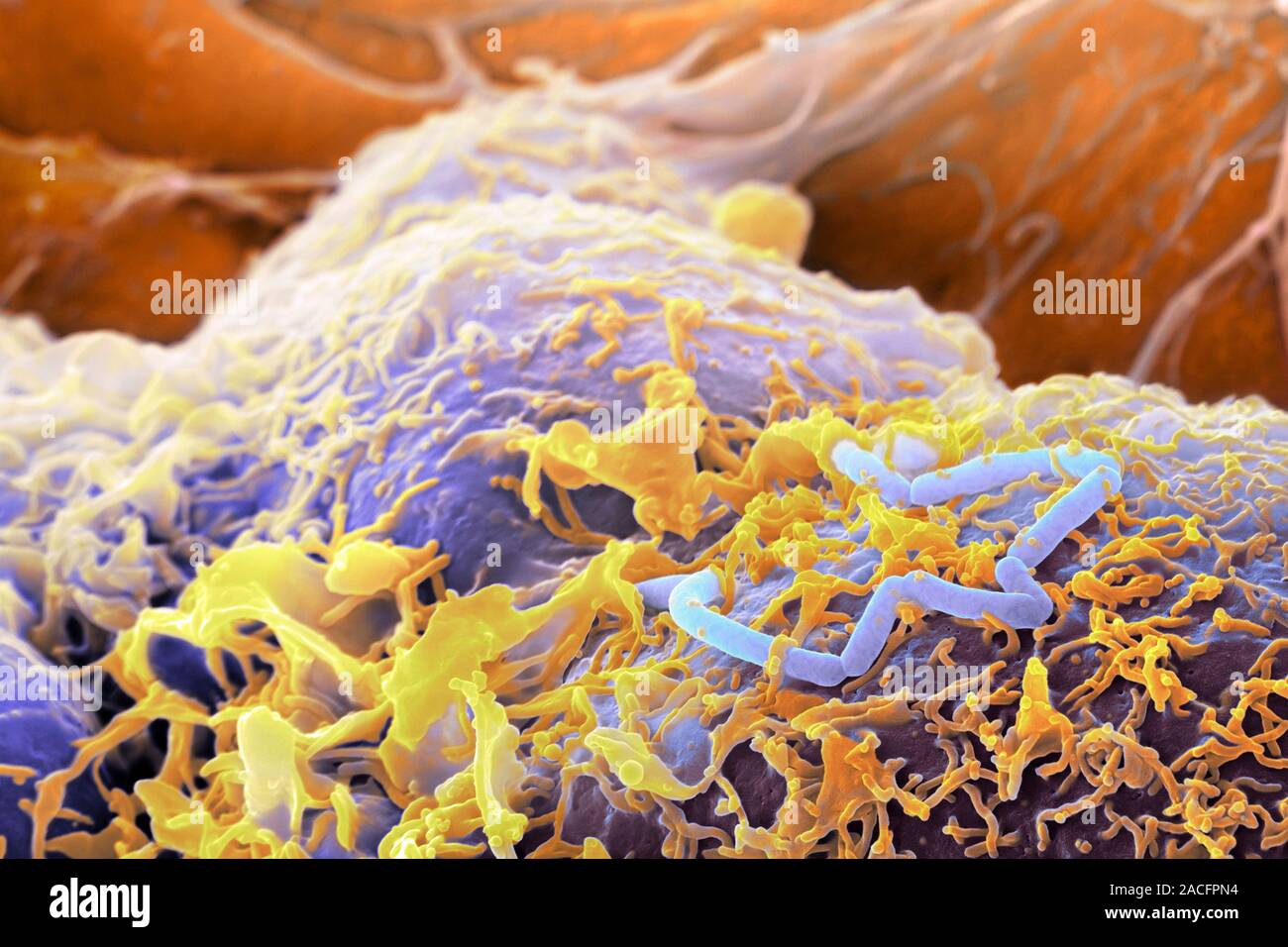 Listeria sp. bacteria, coloured scanning electron micrograph (SEM ...