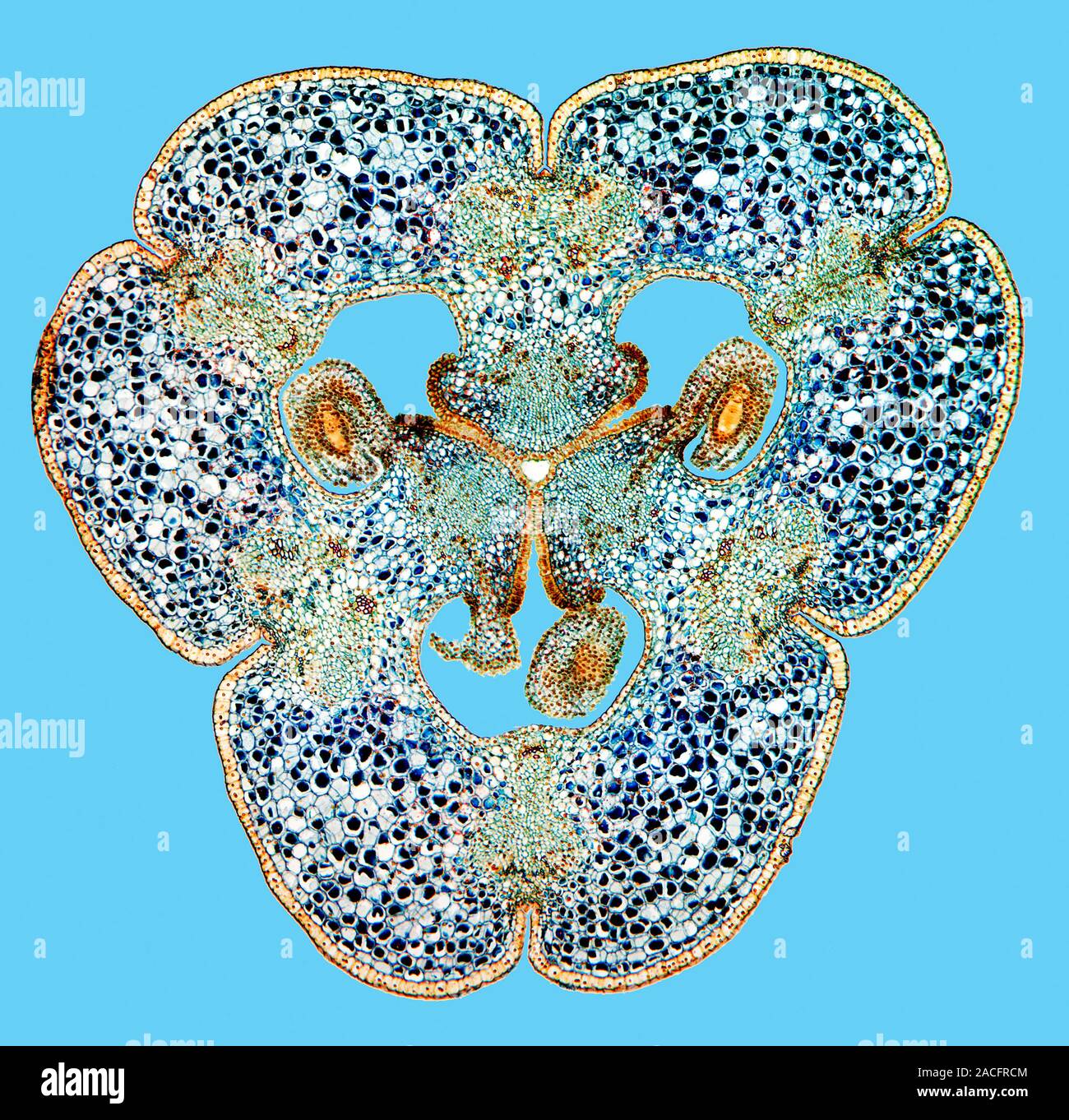Lily carpel. Light micrograph of a cross-section through a lily flower ...
