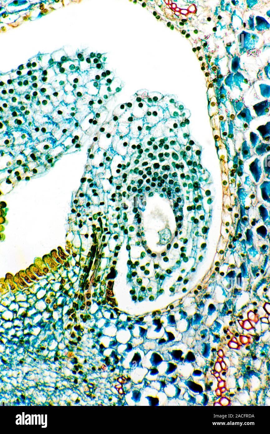 Lily carpel. Light micrograph of a cross-section through a lily flower ...