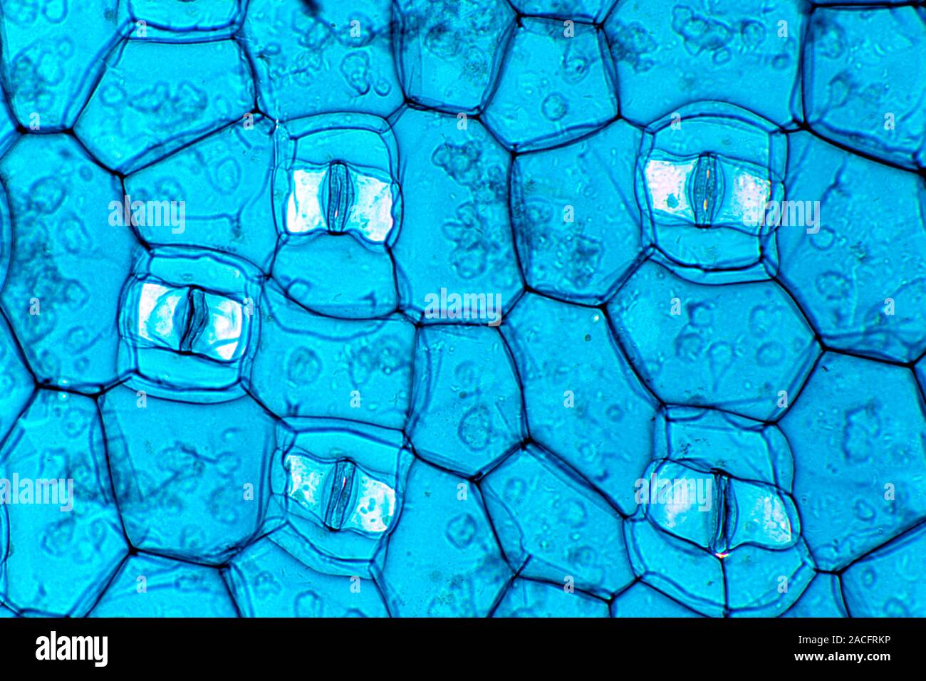 Plant stomata. Light micrograph of stomata (dark blue holes) on the ...