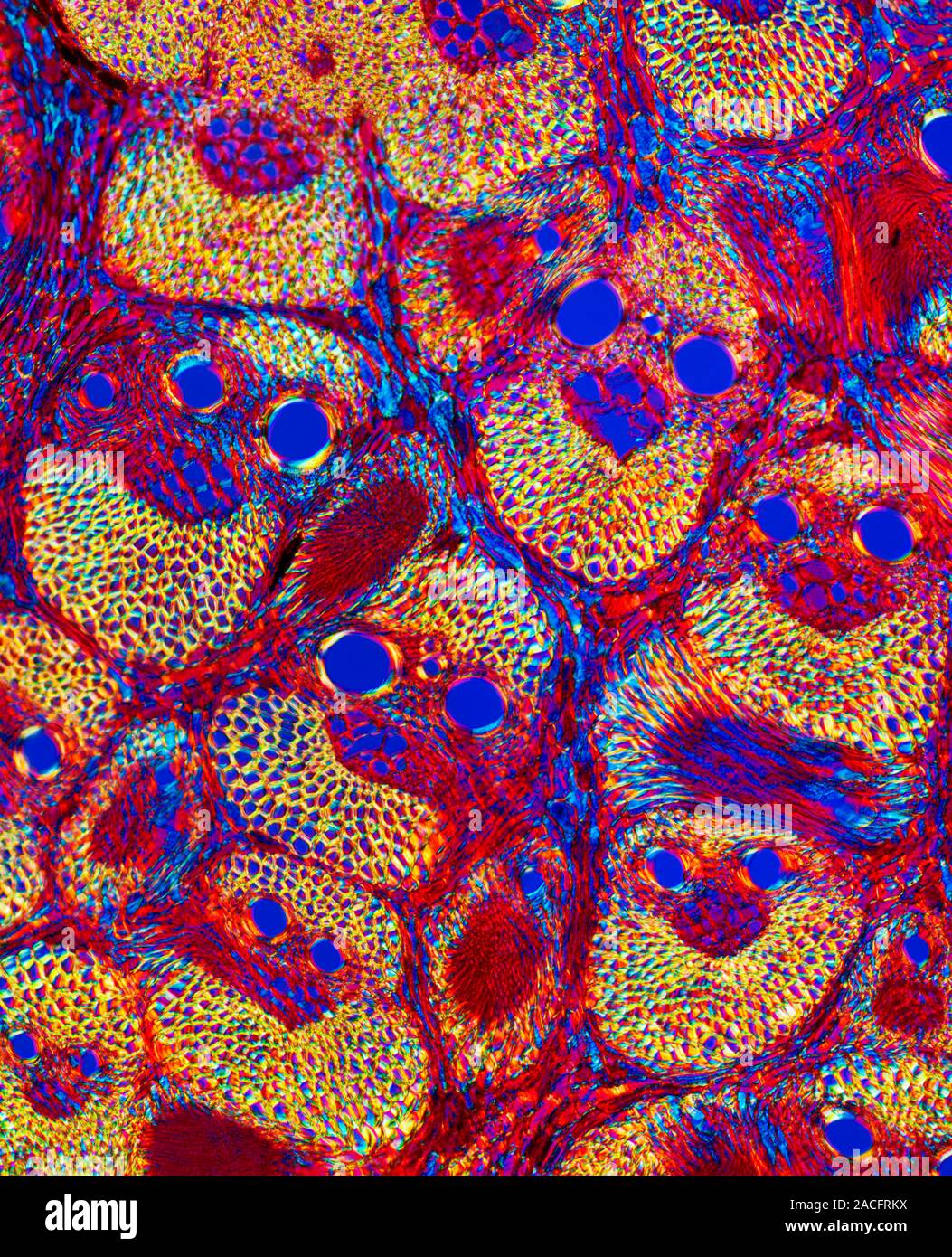 Bamboo stem. Polarised light micrograph of a section through a bamboo ...