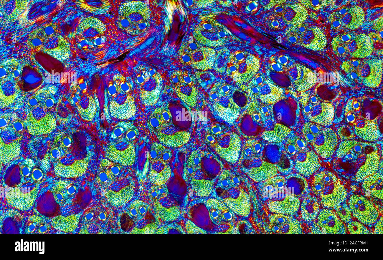 Bamboo stem. Polarised light micrograph of a section through a bamboo ...