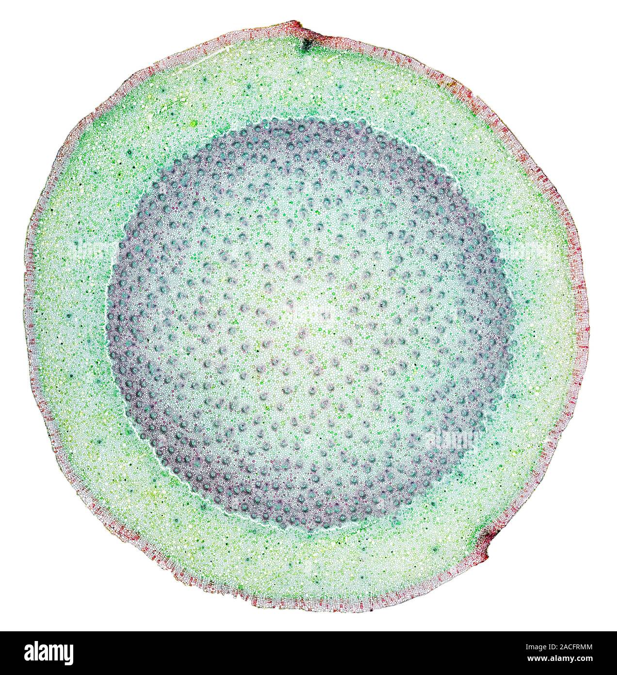 Dragon tree stem. Light micrograph of a section through a dragon tree ...