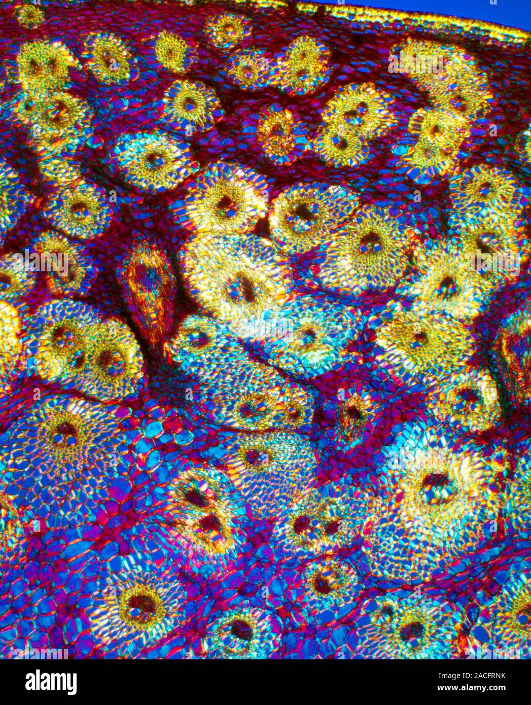 Sugar cane stem. Polarised light micrograph of a section through a ...
