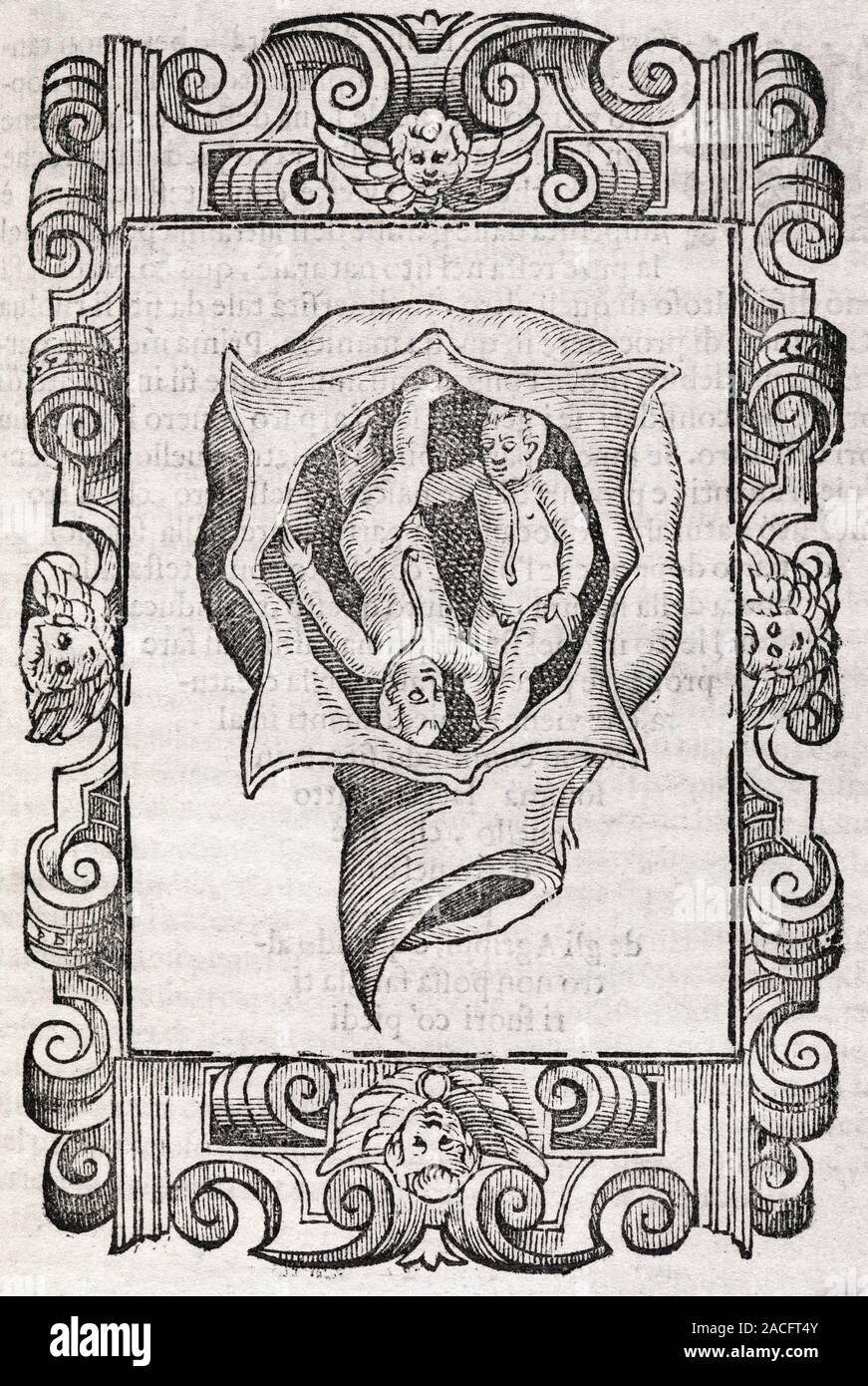 Twin foetuses, 17th century artwork. Twin foetuses in a dissected womb ...