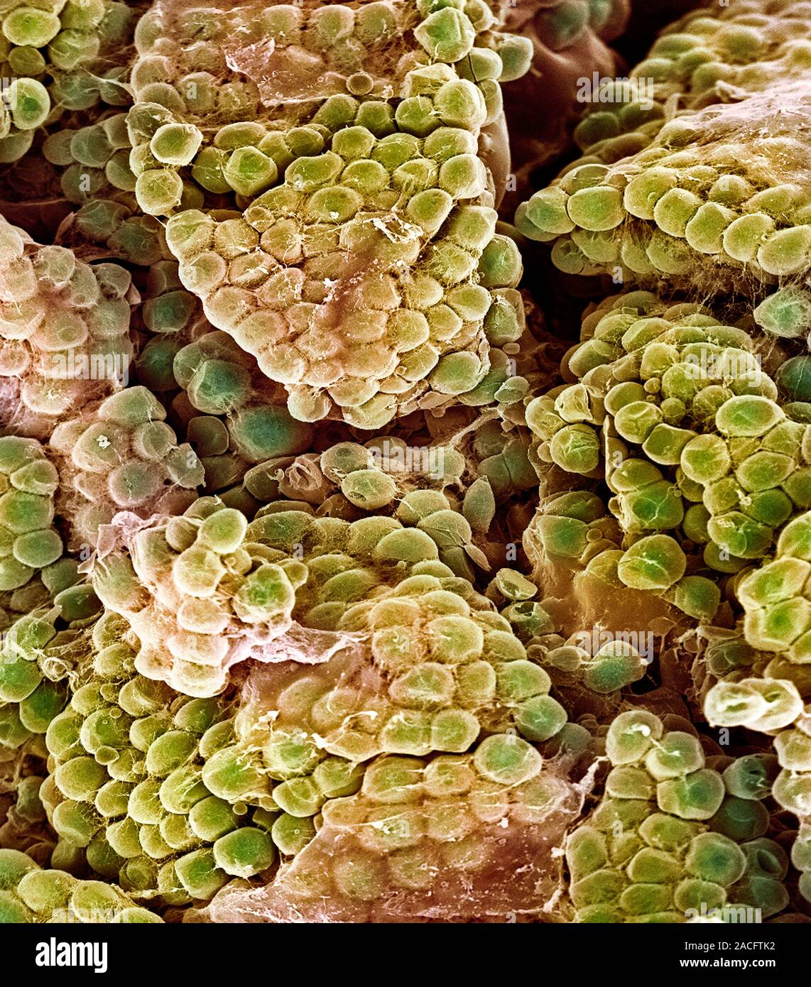 Fat cells, or adipocytes, coloured scanning electron micrograph (SEM ...