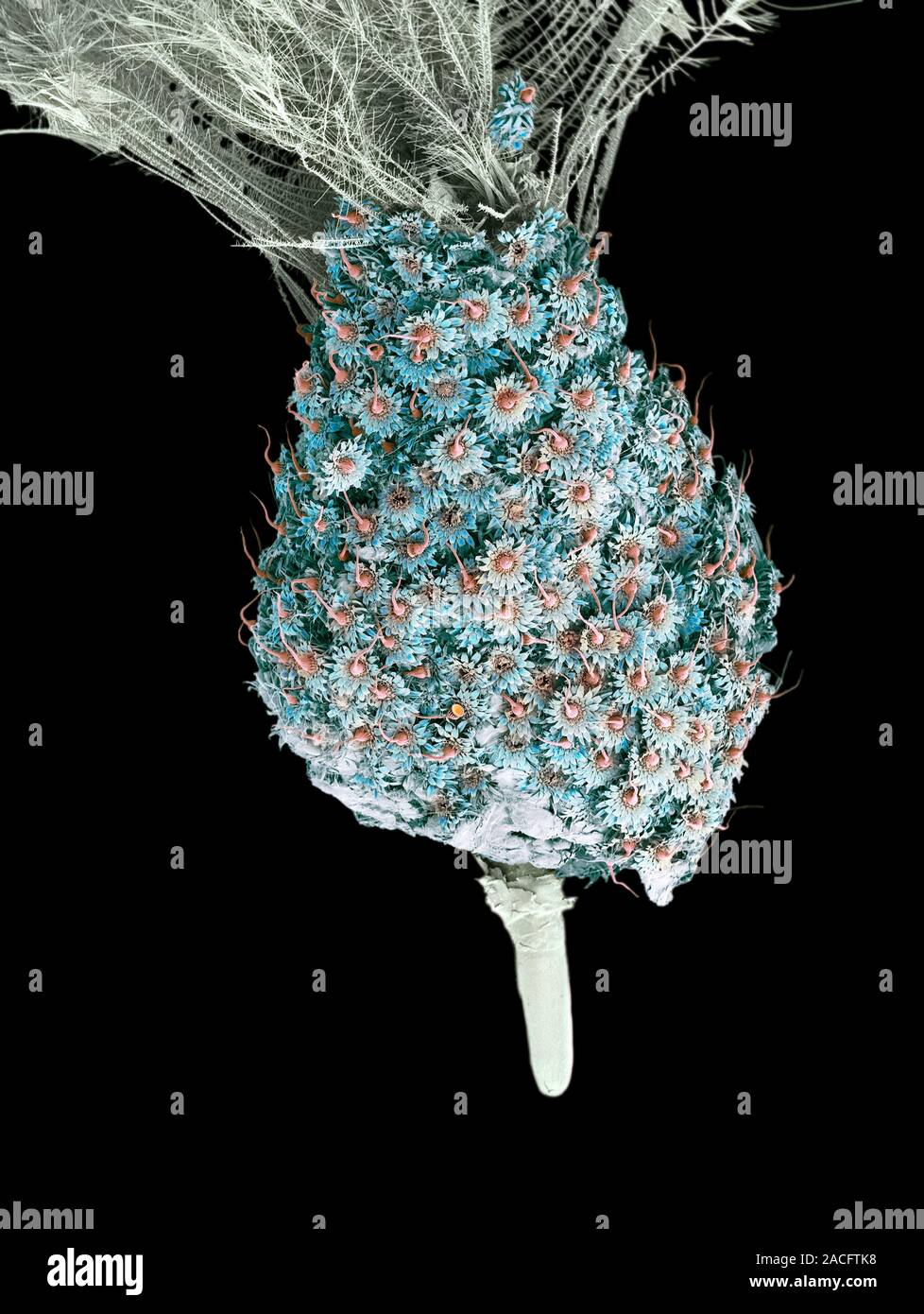 Chicken body louse eggs. Coloured scanning electron micrograph (SEM) of ...
