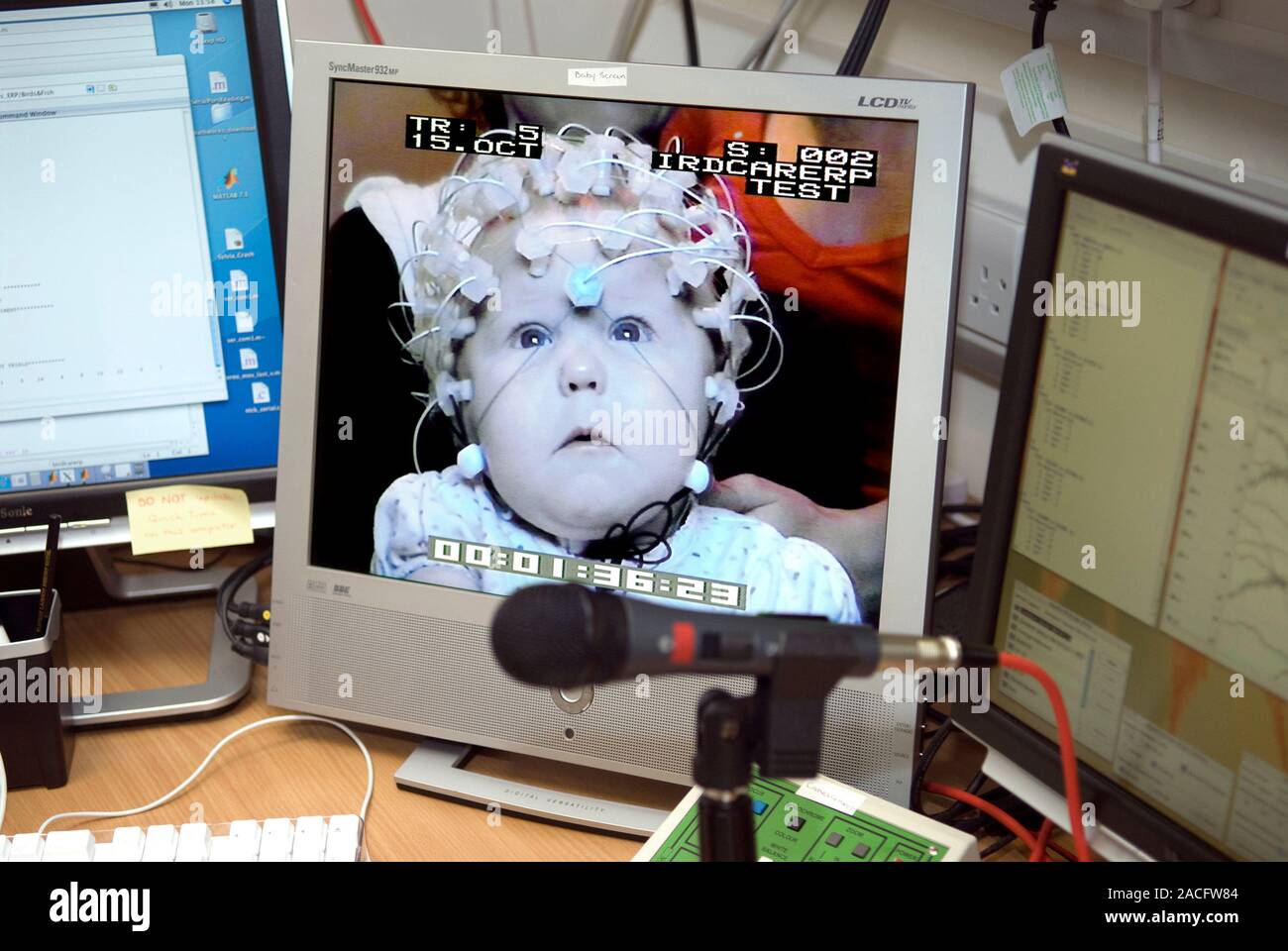 Baby electroencephalography. Video link showing a 6-month-old baby ...