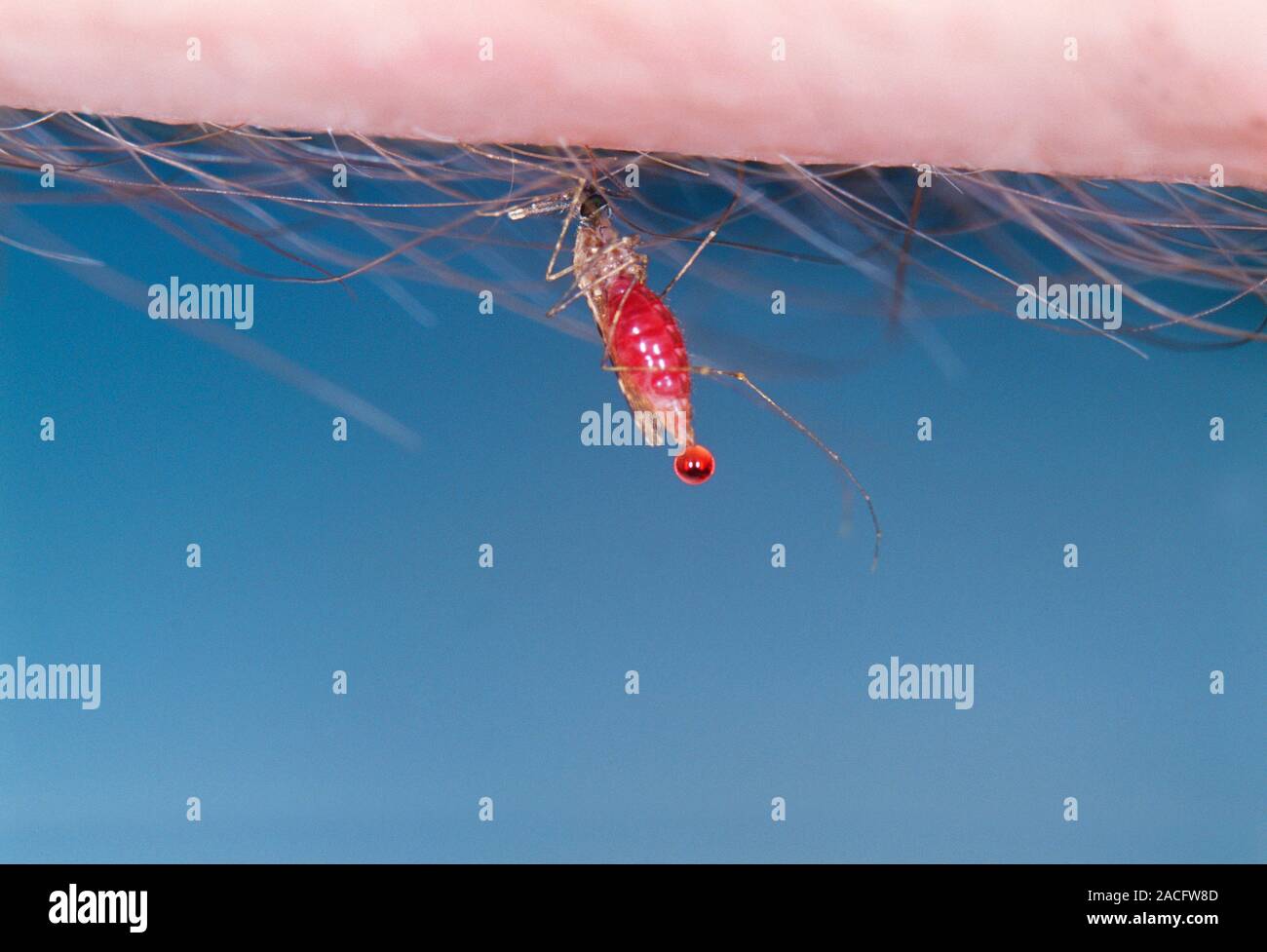 Mosquito feeding on human skin. Anopheles mosquito feeding on human ...