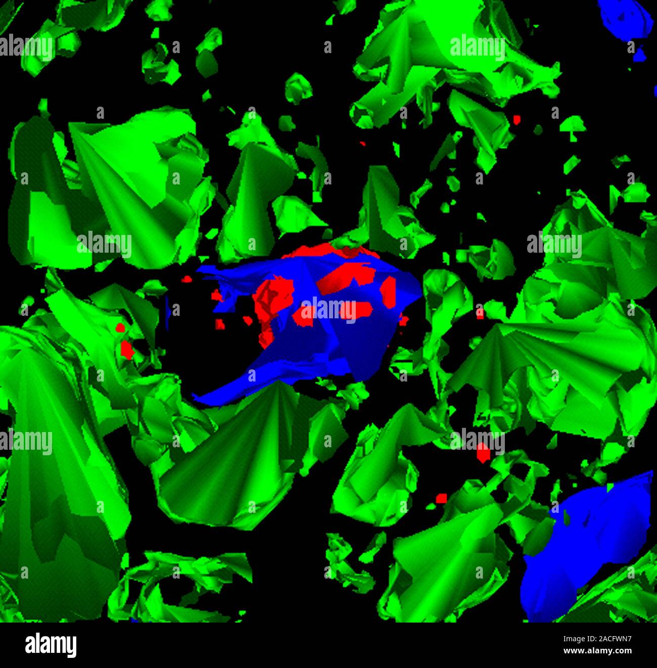 Heart failure. Fluorescent deconvolution micrograph of heart muscle ...