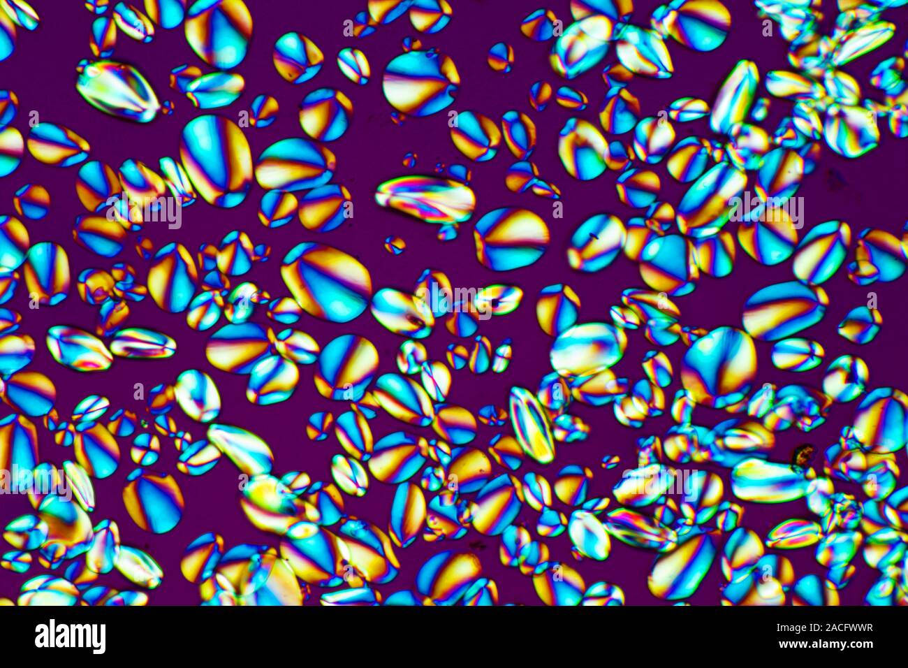 Starch grains. Polarised light micrograph of starch grains from a lily ...