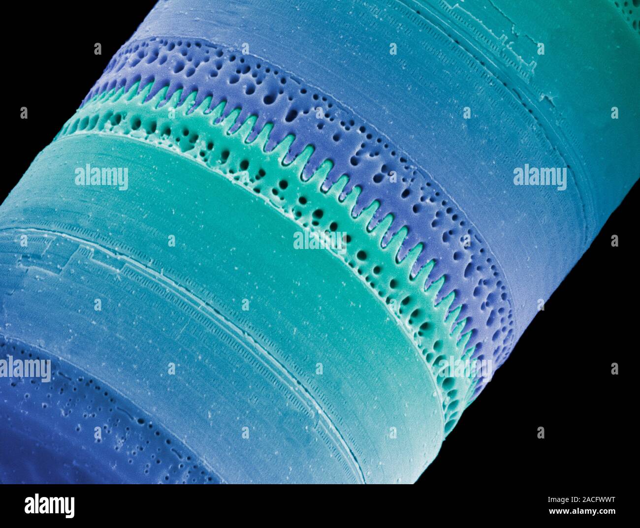 Diatom. Coloured scanning electron micrograph (SEM) of the wall of the ...