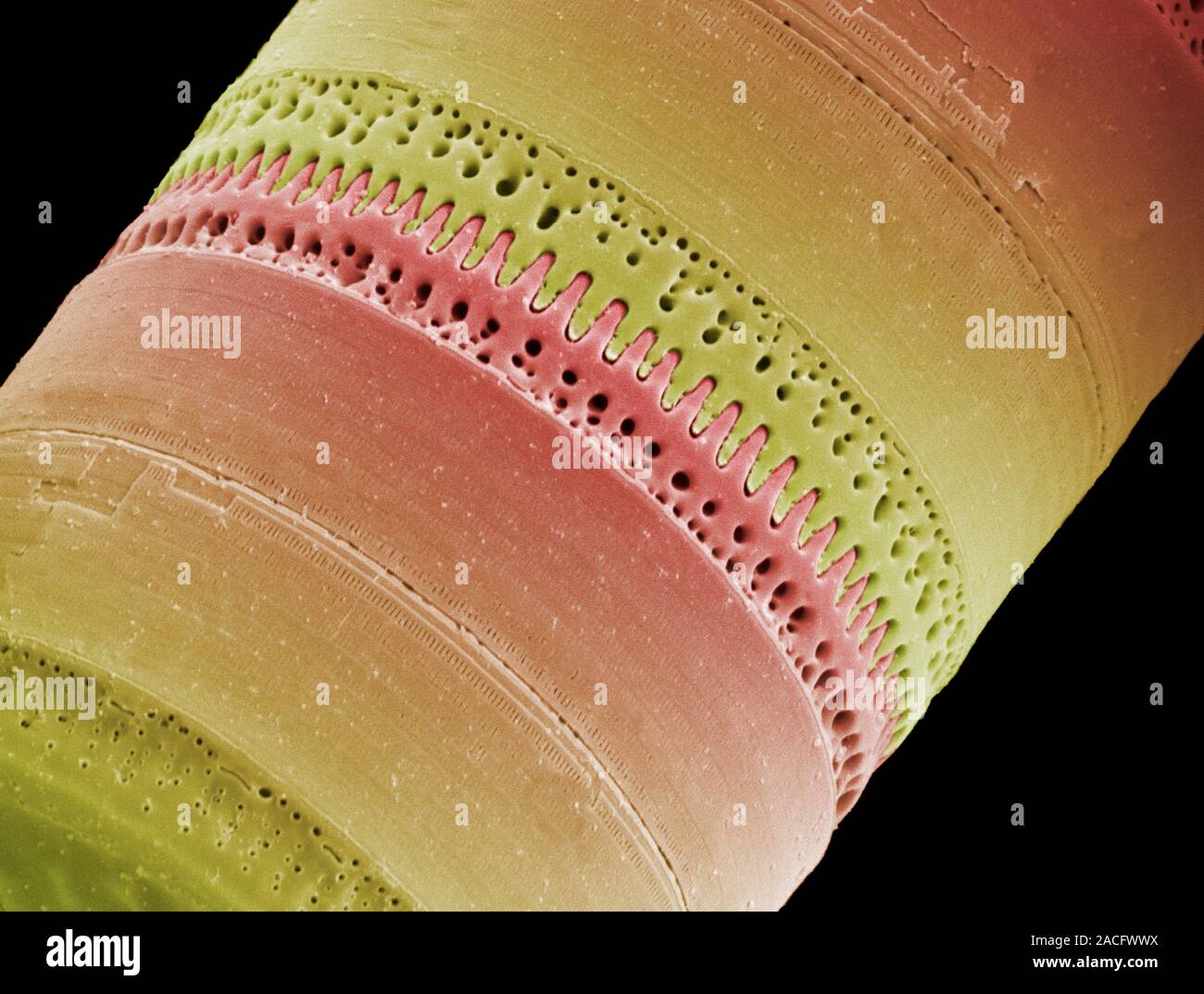 Diatom. Coloured scanning electron micrograph (SEM) of the wall of the ...