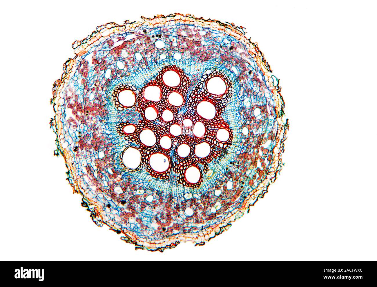 Sweet potato root. Light micrograph of a transverse section through a ...