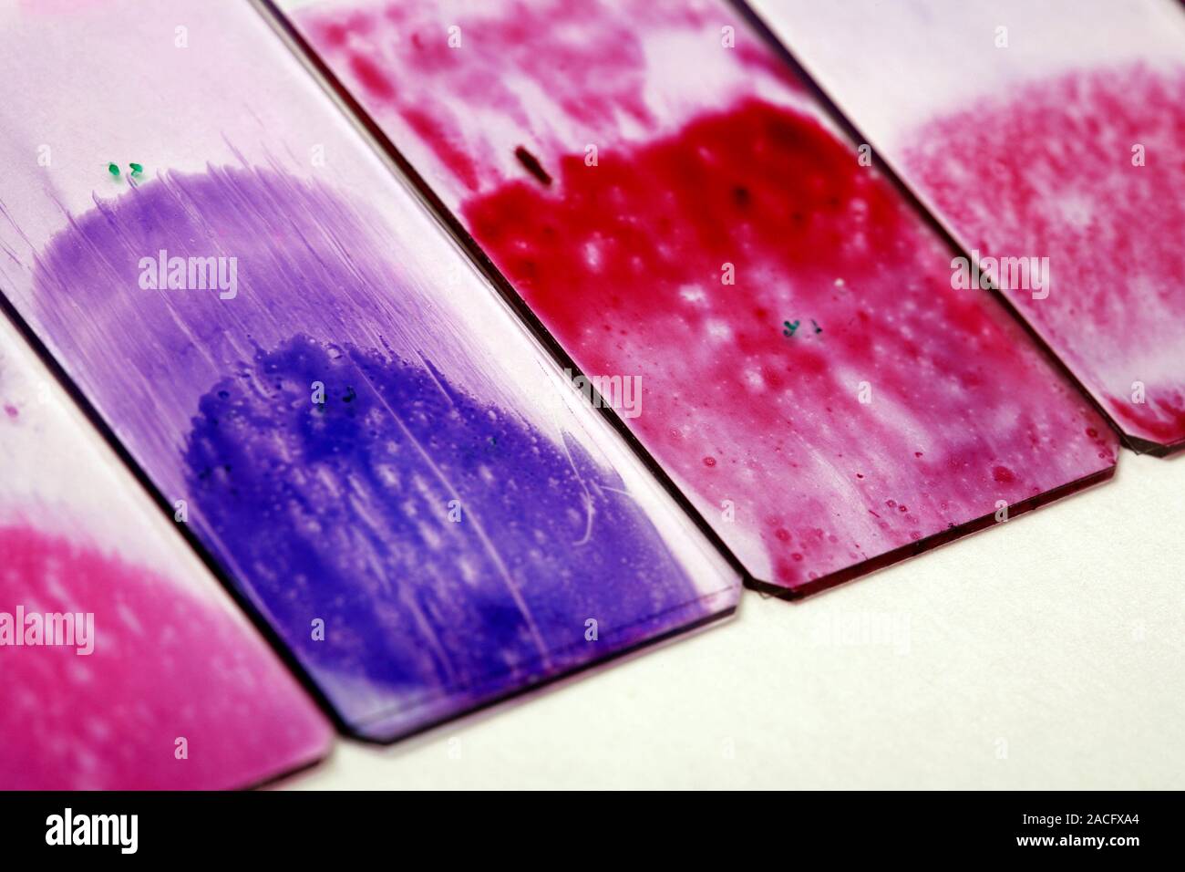 Cervical smear slides. Close up of the tips of stained cervical smear ...