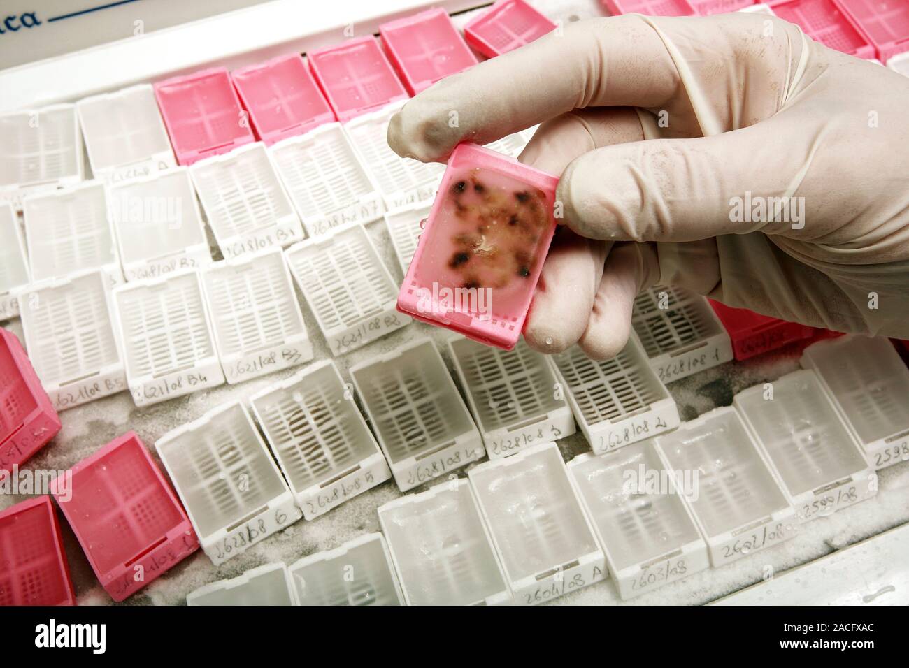 Wax prepared pathology specimens. Person holding one of a number of ...
