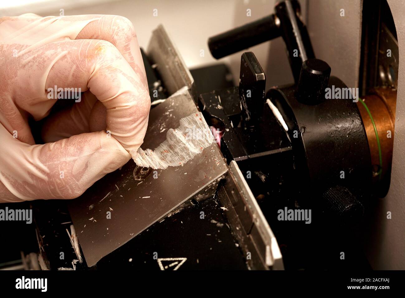 Pathology specimen wax preparation. Woman using a machine to slice thin ...