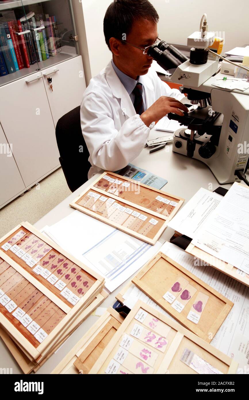 Examining tissue samples. Pathologist examining tissue samples under a ...