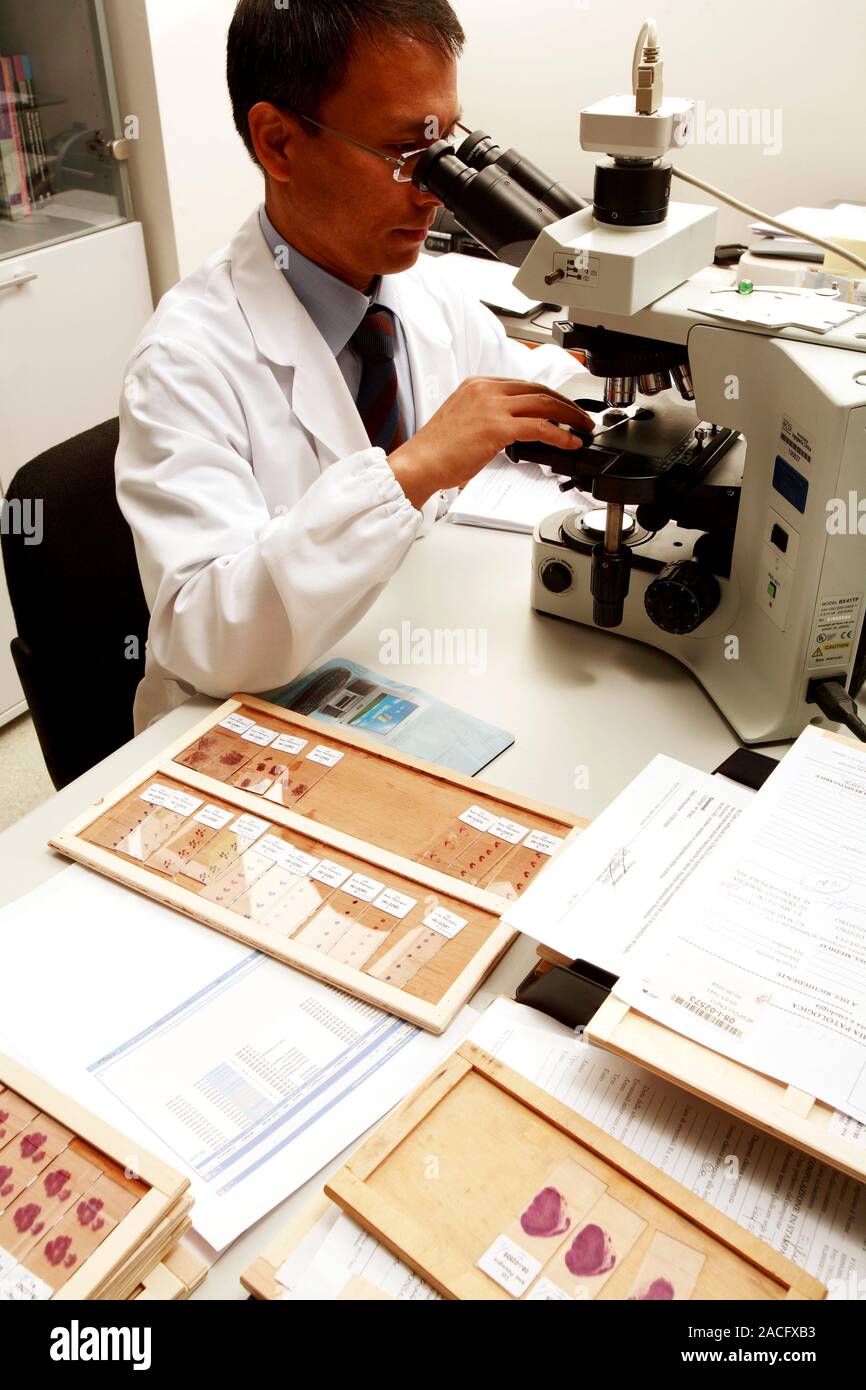 Examining tissue samples. Pathologist examining tissue samples under a ...