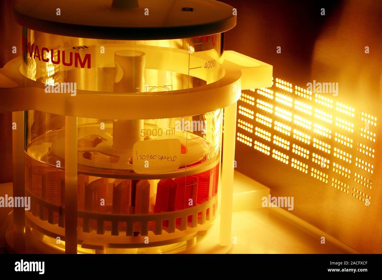 Microwave histology processor. Histology specimens in a Histos 5 rapid ...