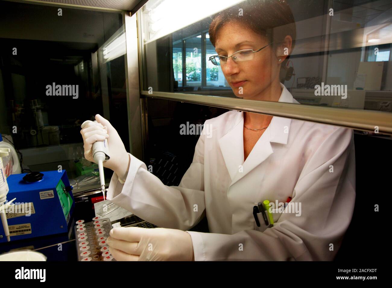Histology laboratory. Technician using a pipette, to fill sample trays ...