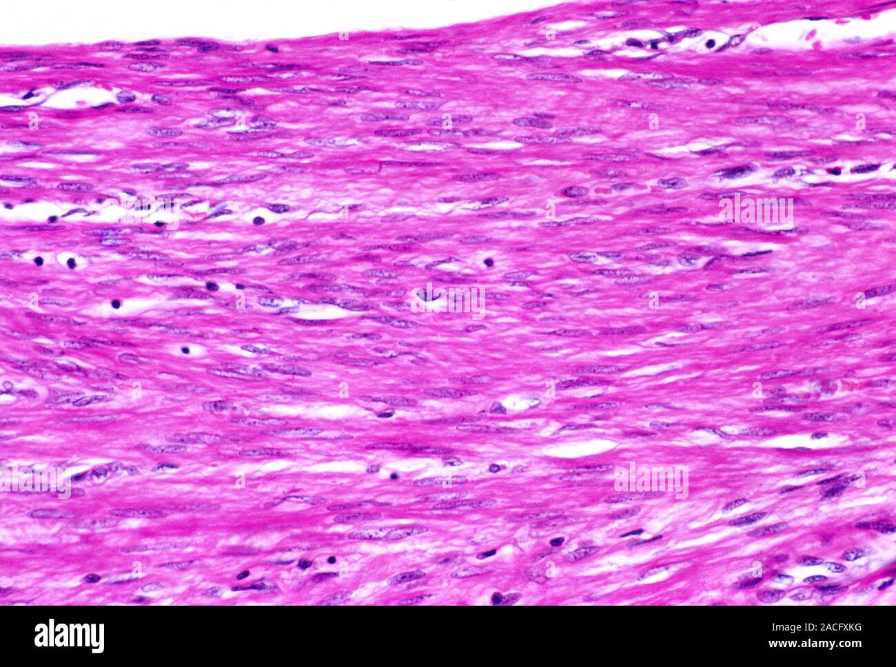 Normal uterus wall. Light micrograph of a section through the middle ...