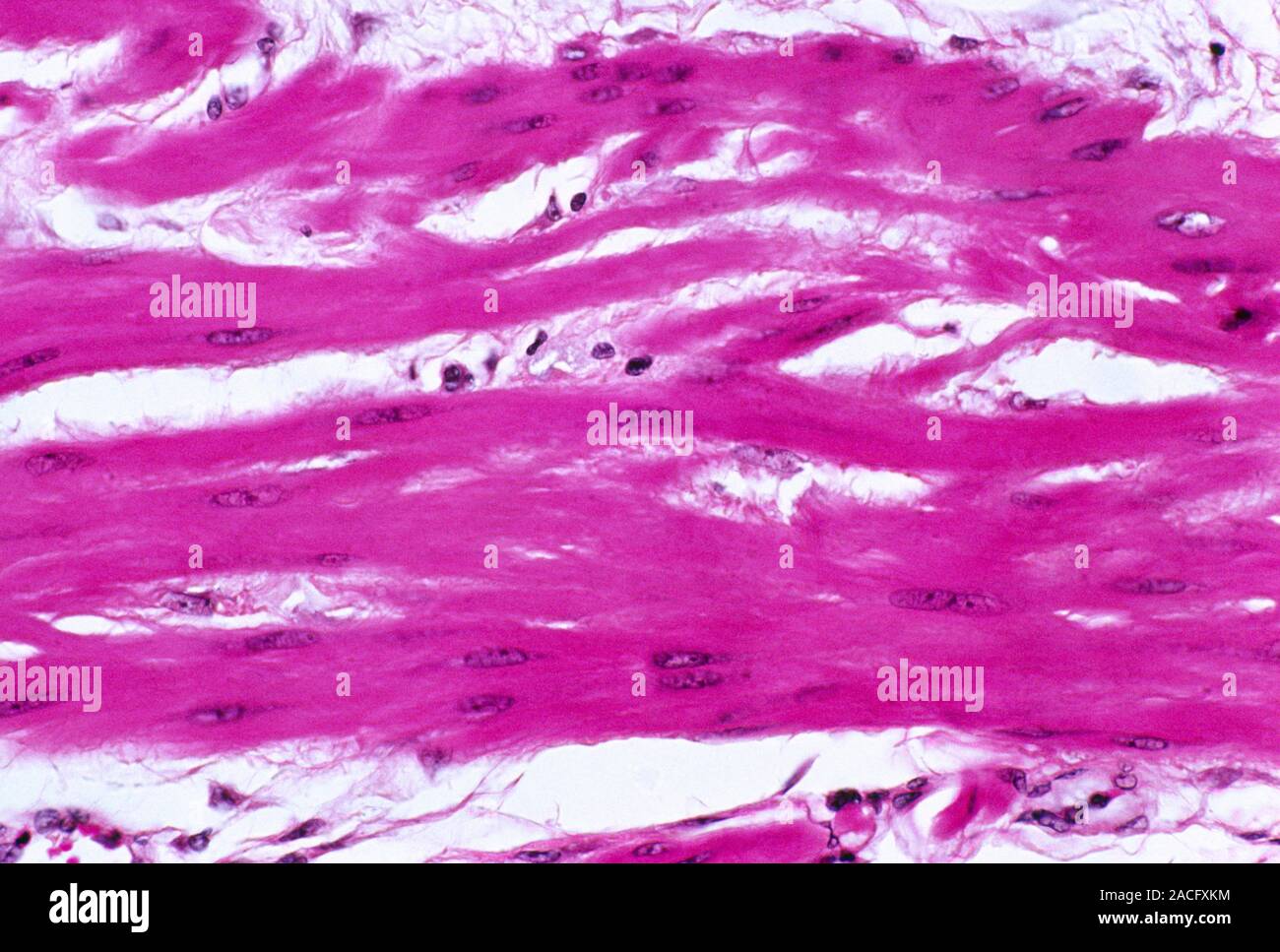 Pregnant uterus wall. Light micrograph of a section through the middle ...
