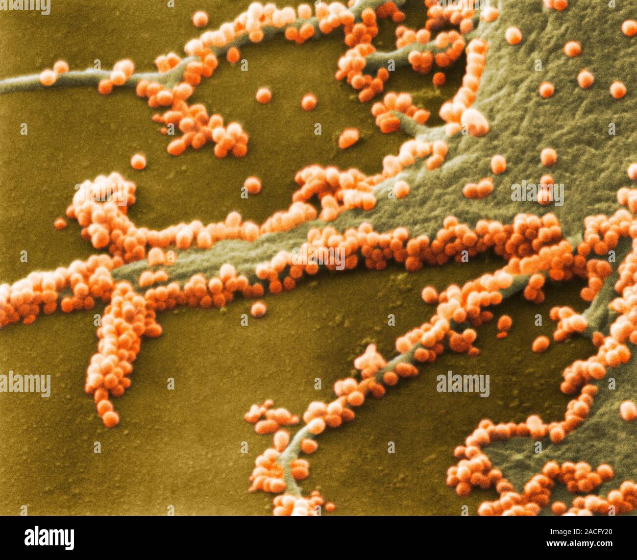 H1N1 flu virus particles (virions, orange) on a cell (green), coloured ...