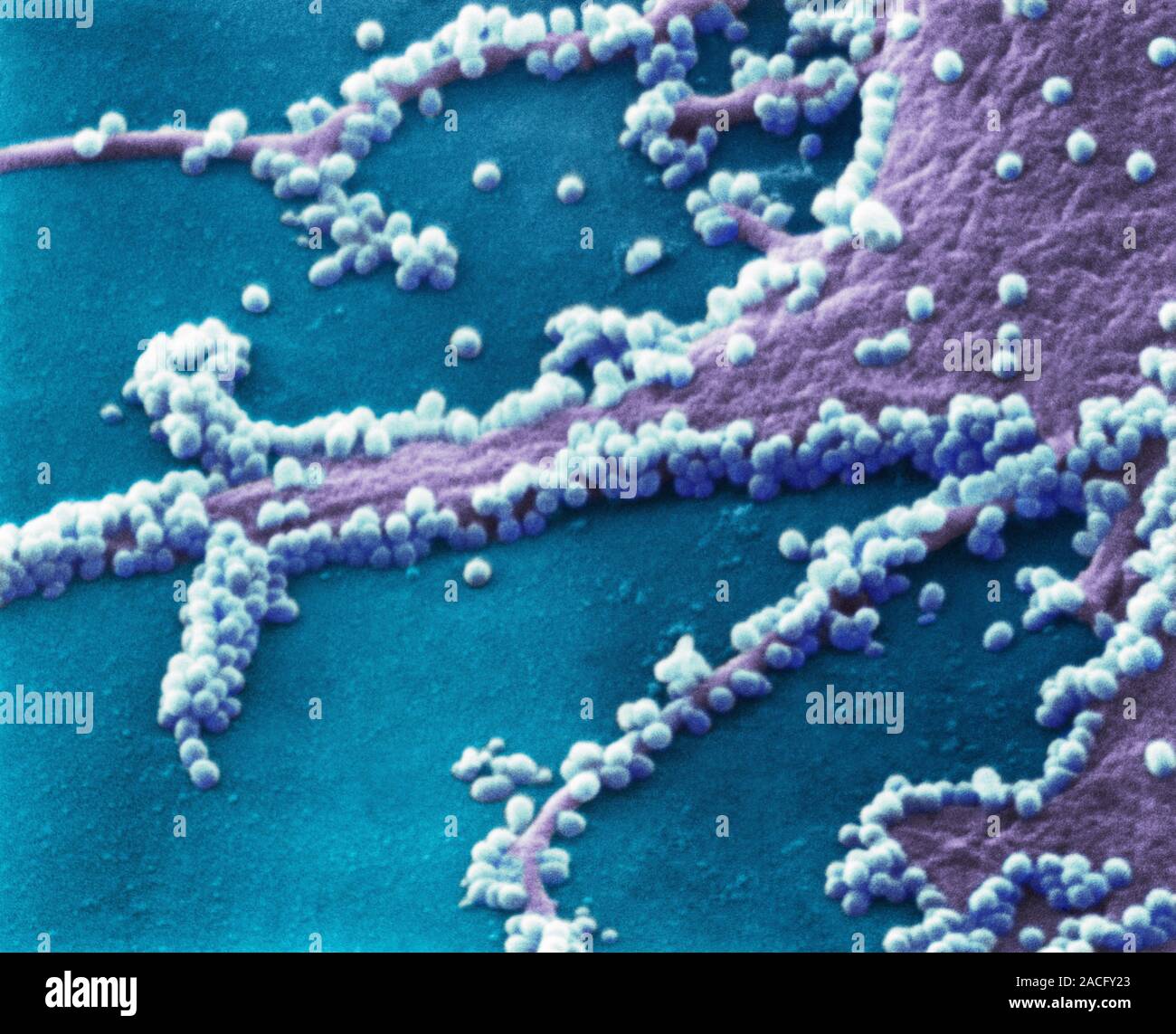 H1N1 flu virus particles (virions, blue) on a cell (purple), coloured ...