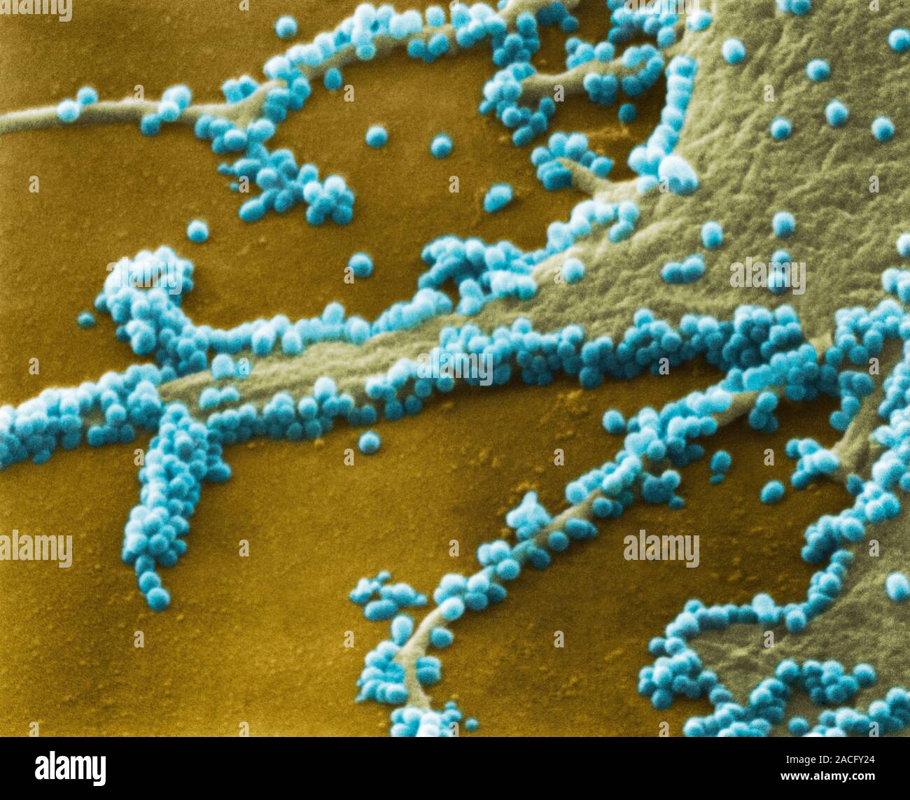 H1N1 flu virus particles (virions, blue) on a cell (green), coloured ...