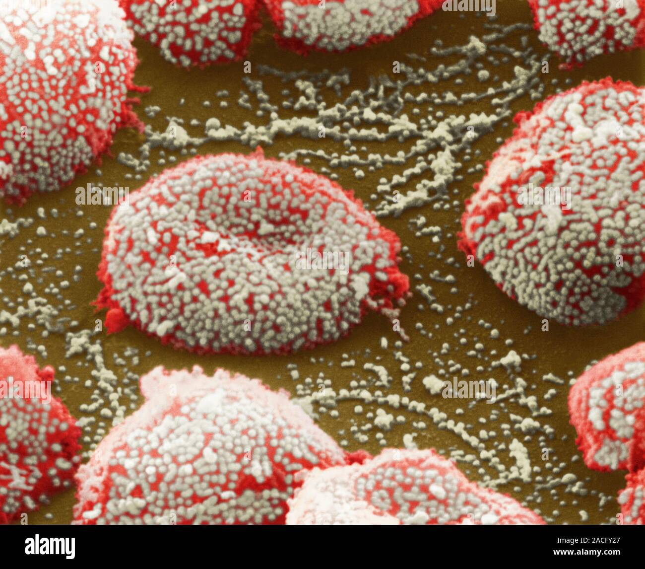 Flu (influenza) virus particles (pale specks) on red blood cells ...