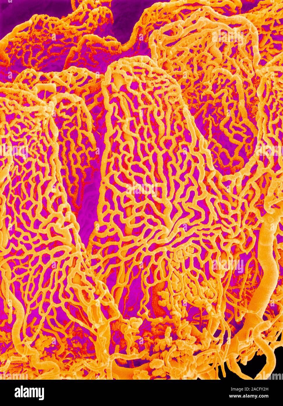 Small intestine blood vessels. Coloured scanning electron micrograph ...