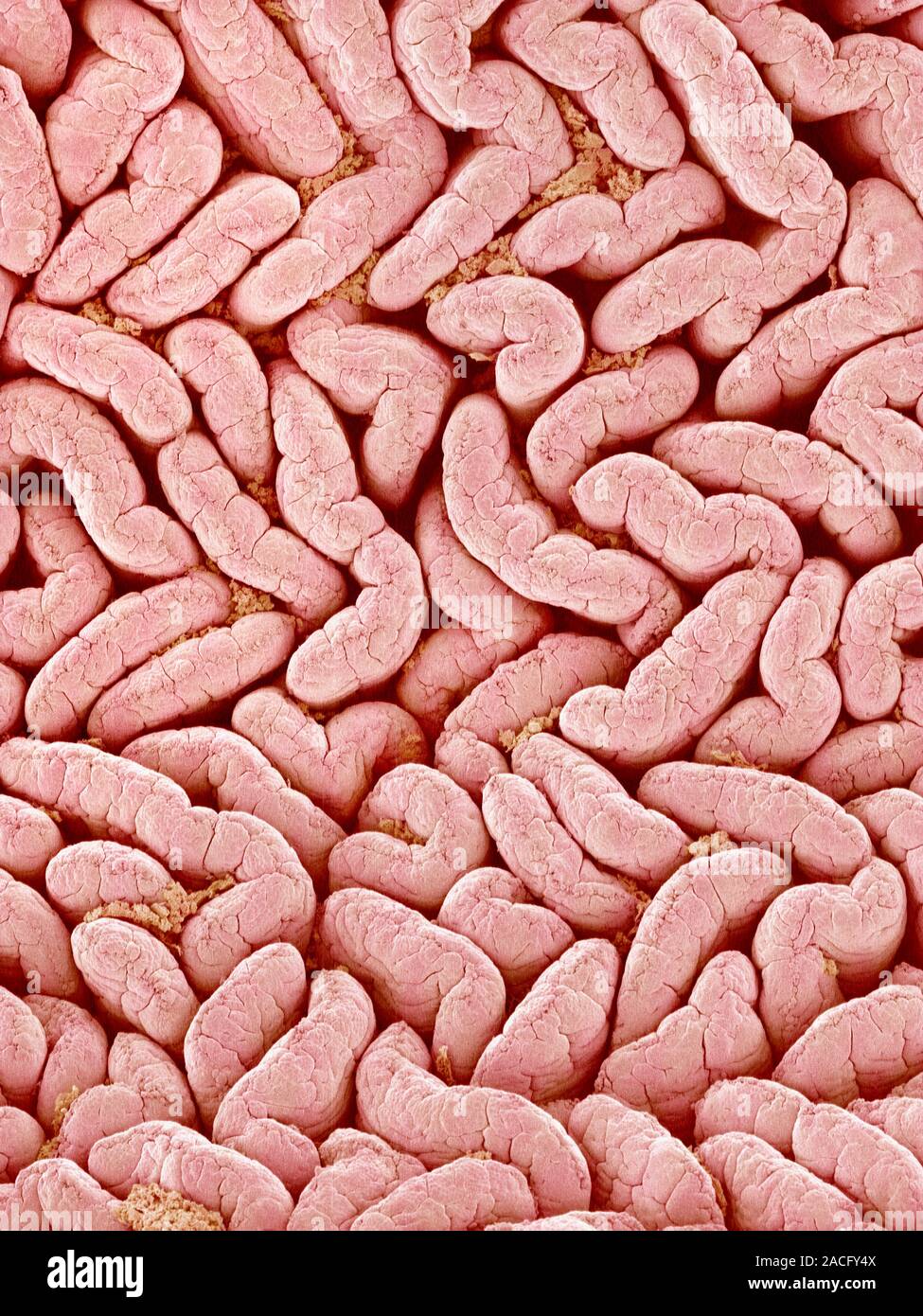 Intestinal lining. Coloured scanning electron micrograph (SEM) of villi ...