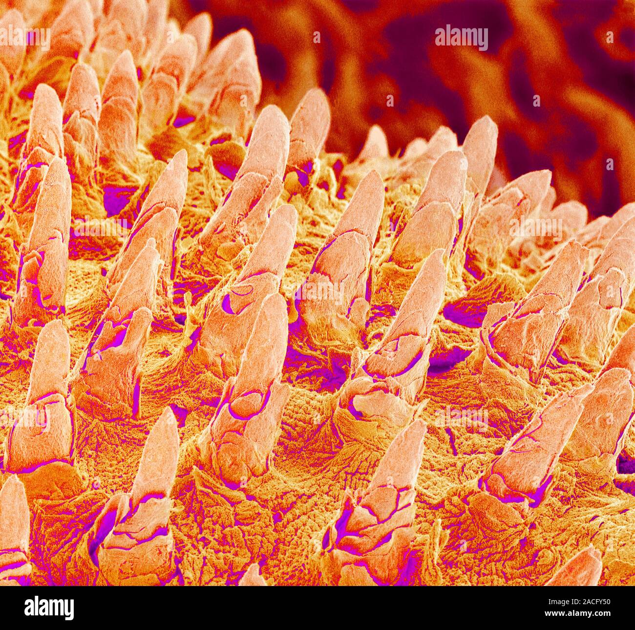 Tongue surface, coloured scanning electron micrograph (SEM). The tongue ...