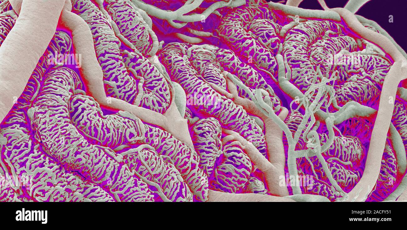 Blood vessels. Coloured scanning electron micrograph (SEM) of a resin ...