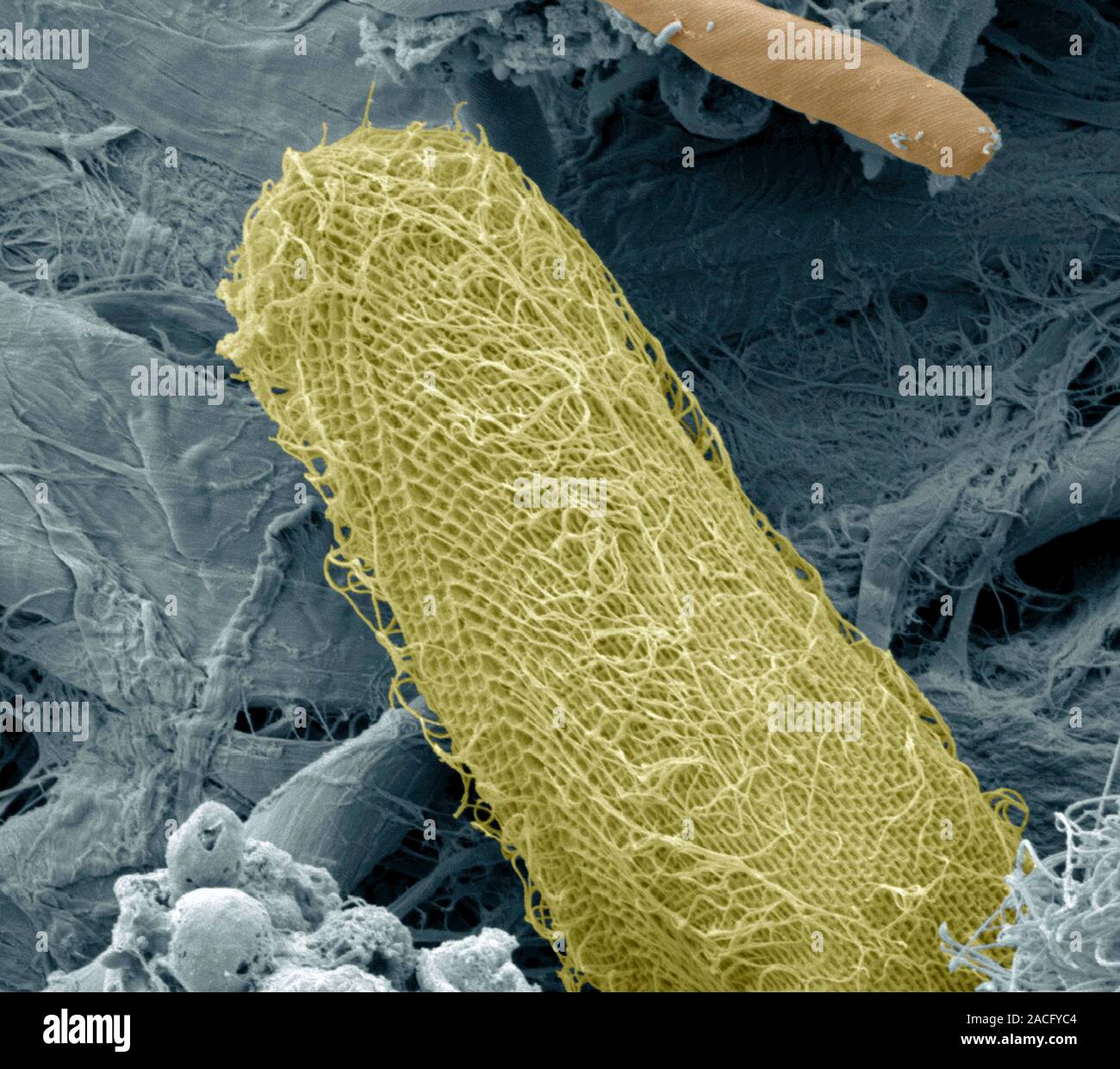 Ciliate protozoan. Coloured scanning electron micrograph (SEM) of a ...
