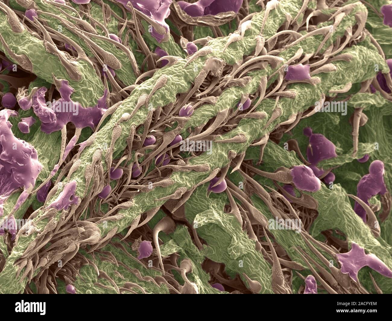 Cannabis plant. Coloured scanning electron micrograph (SEM) of the ...