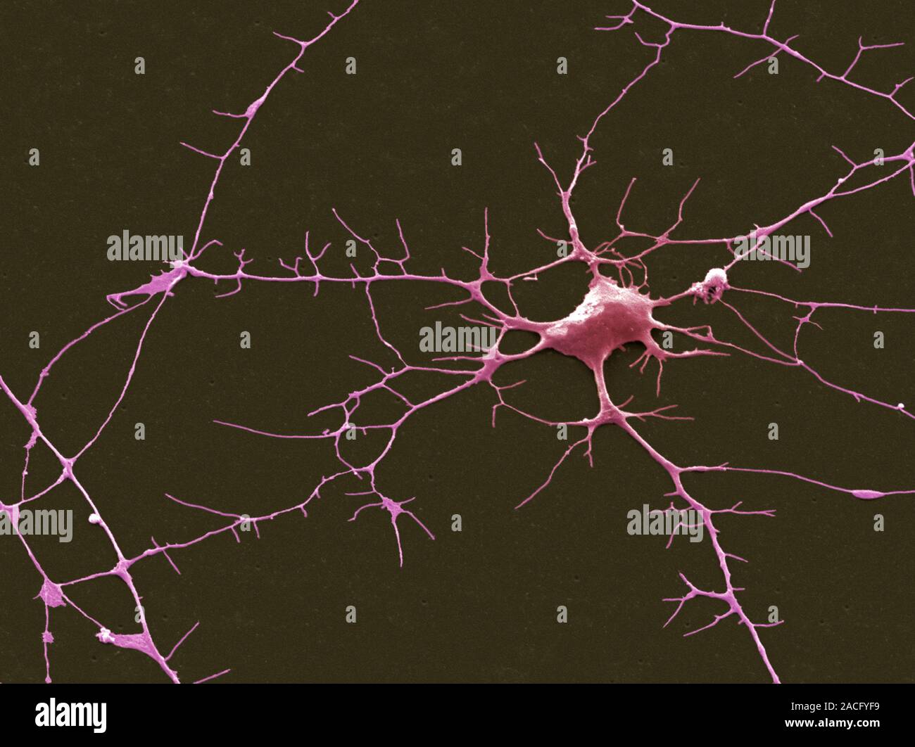 Nerve cell. Coloured scanning electron micrograph (SEM) of a nerve cell ...