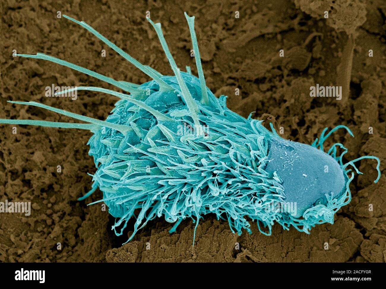 Gastrotrich, coloured scanning electron micrograph (SEM). Gastrotrichs ...